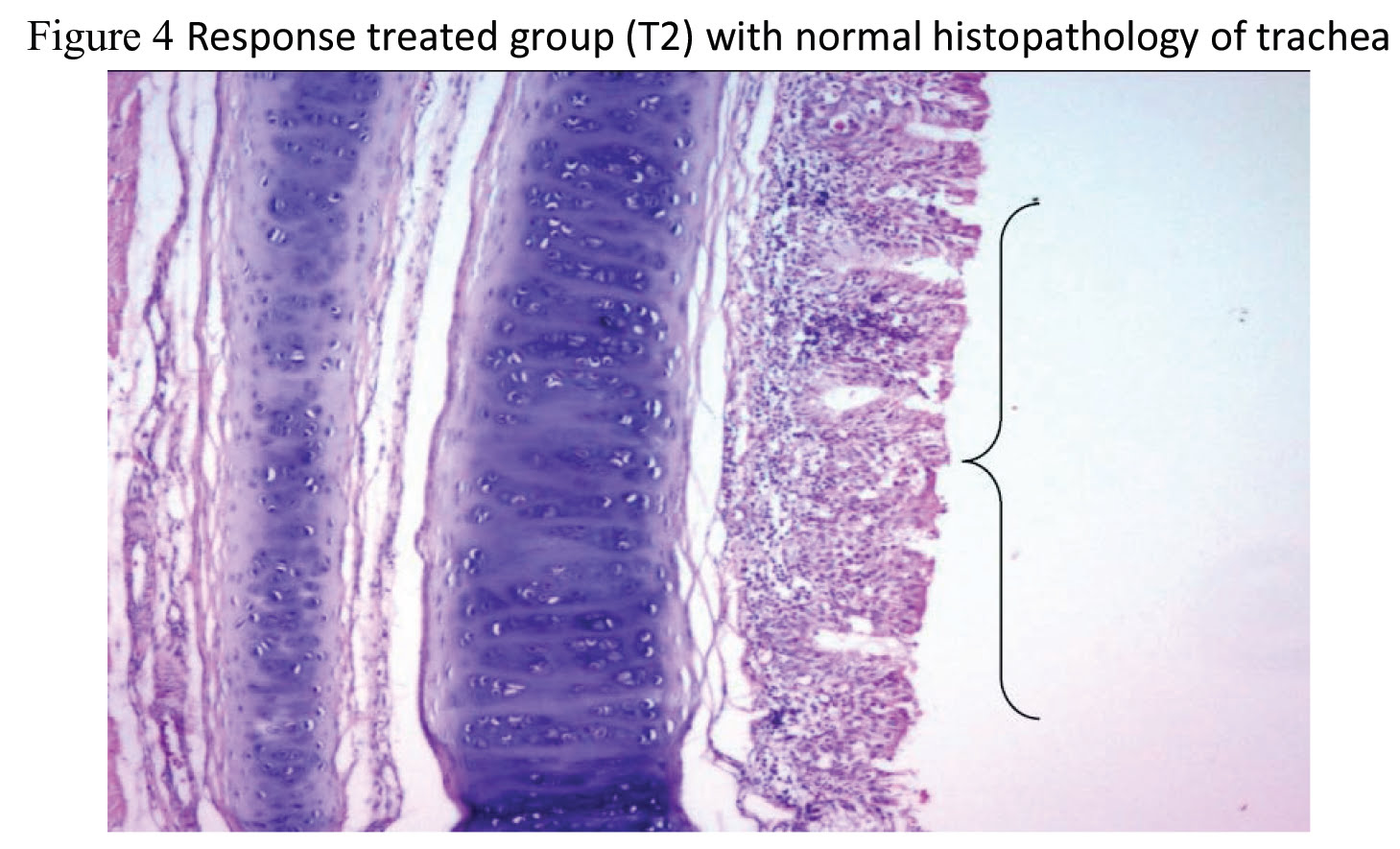 RESPONSE - Eases respiratory distress in poultry